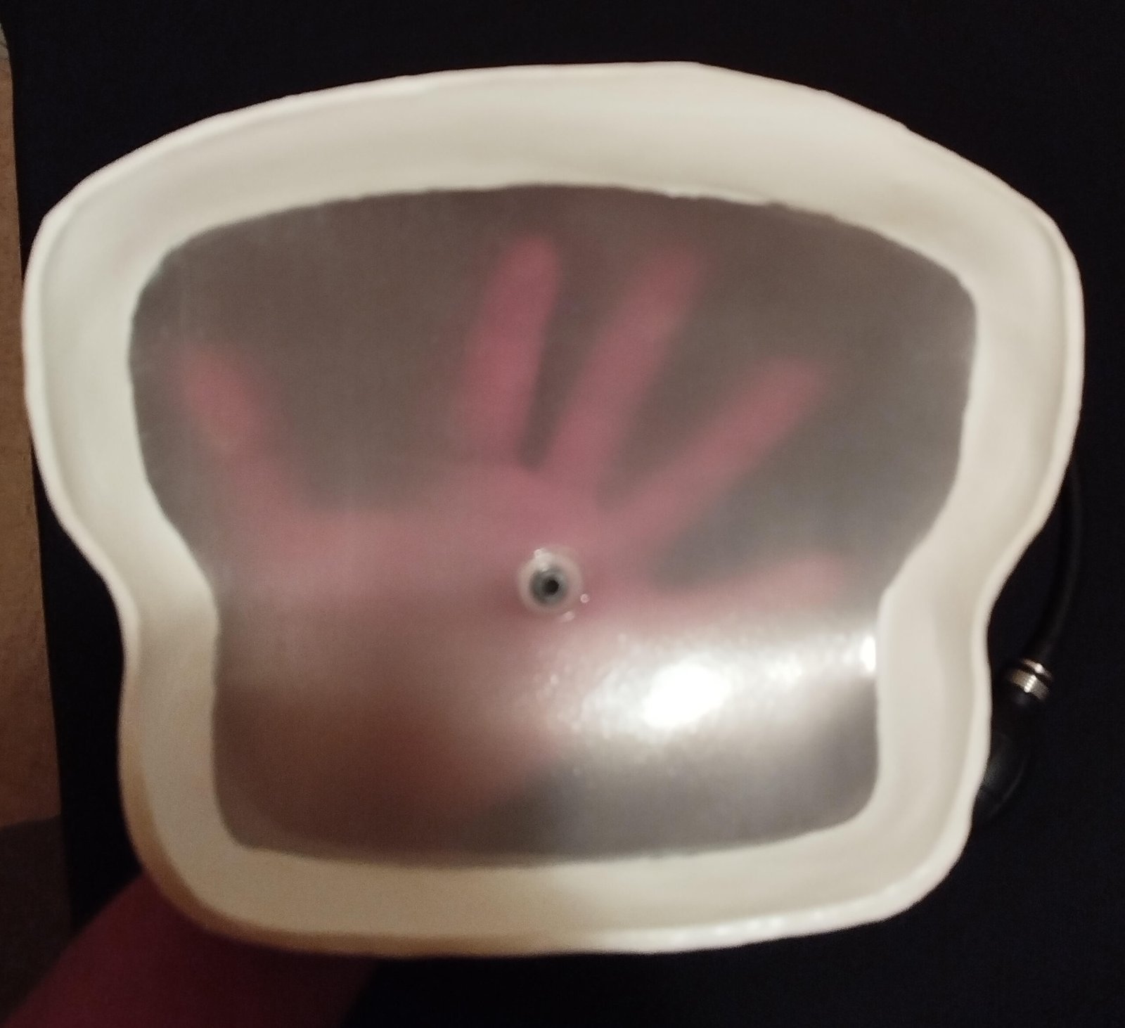 Pectus Excavatum: Vacuum Bell – PectusConnectUs
