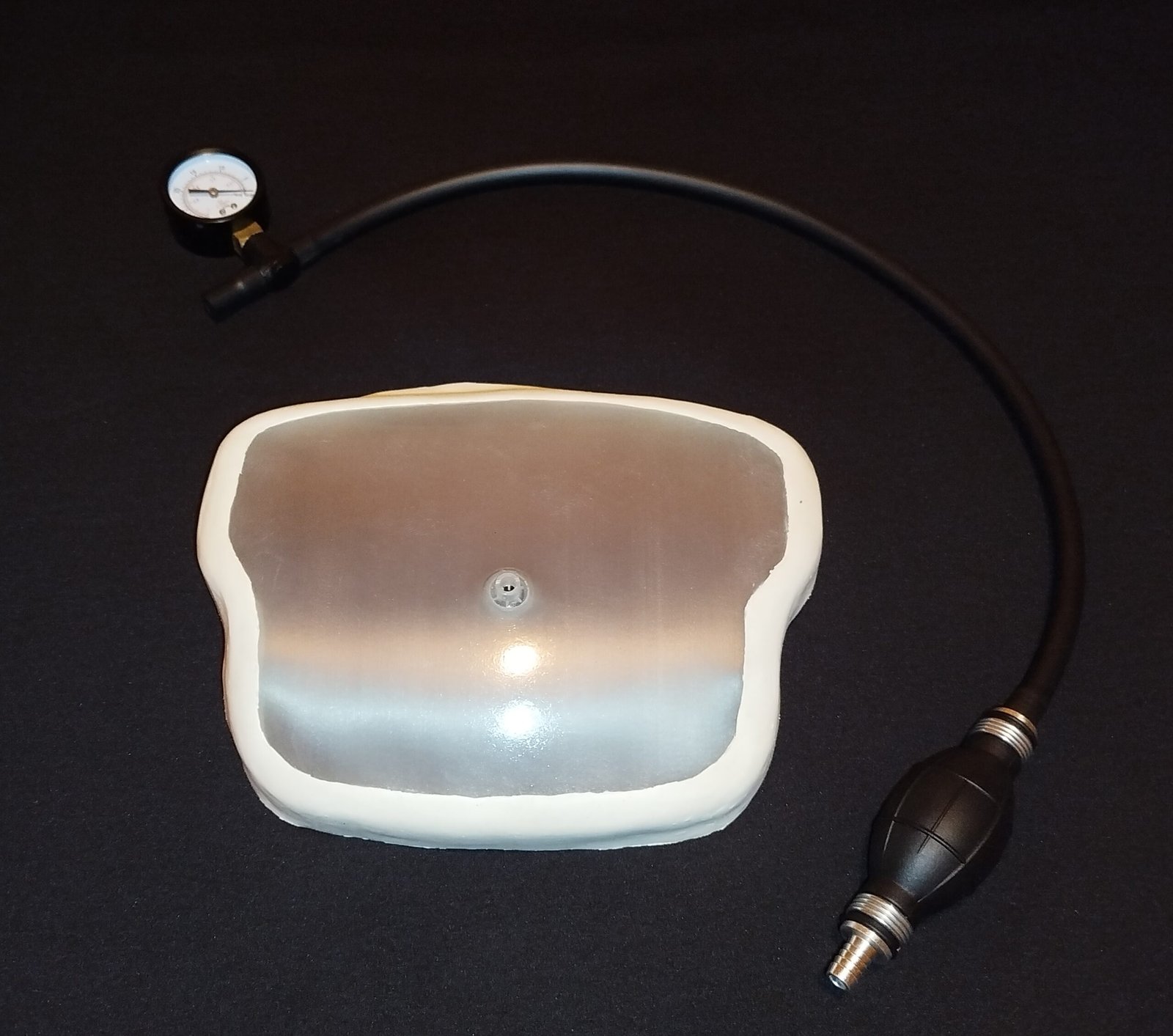 Pectus Excavatum: Vacuum Bell – PectusConnectUs